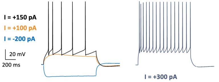 Human Brain Slices - Neuroservice