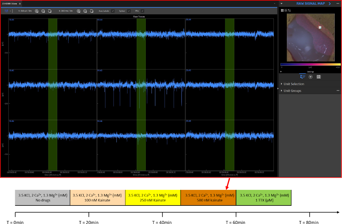Advanced Neuroscience Research with HD-MEA Technology and AI Algorithms ...
